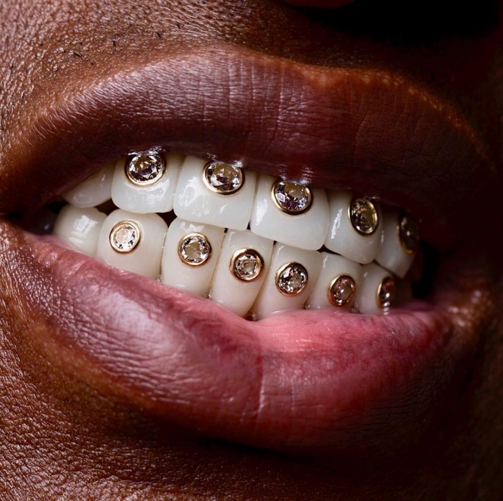 Rapper Birdman Encrusts $100,000 Worth Of Diamonds On His Teeth ...